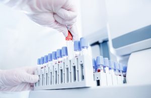 Ancestry DNA Test Kits | Genetrack Australia